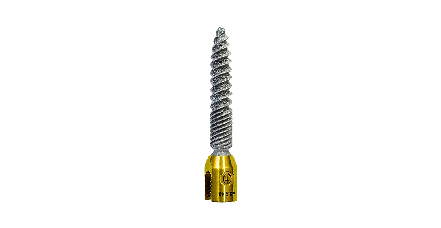 3D Printed Pedicle Screw Innovation | Eminent Spine